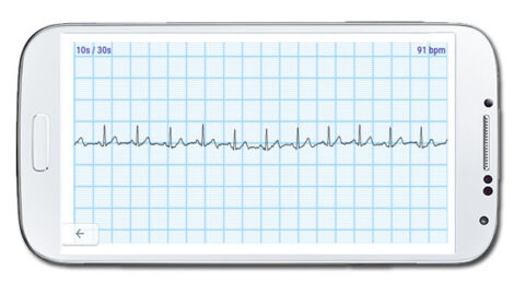 About Electrocardiograms (EKG/ECG) - CardioComm Solutions